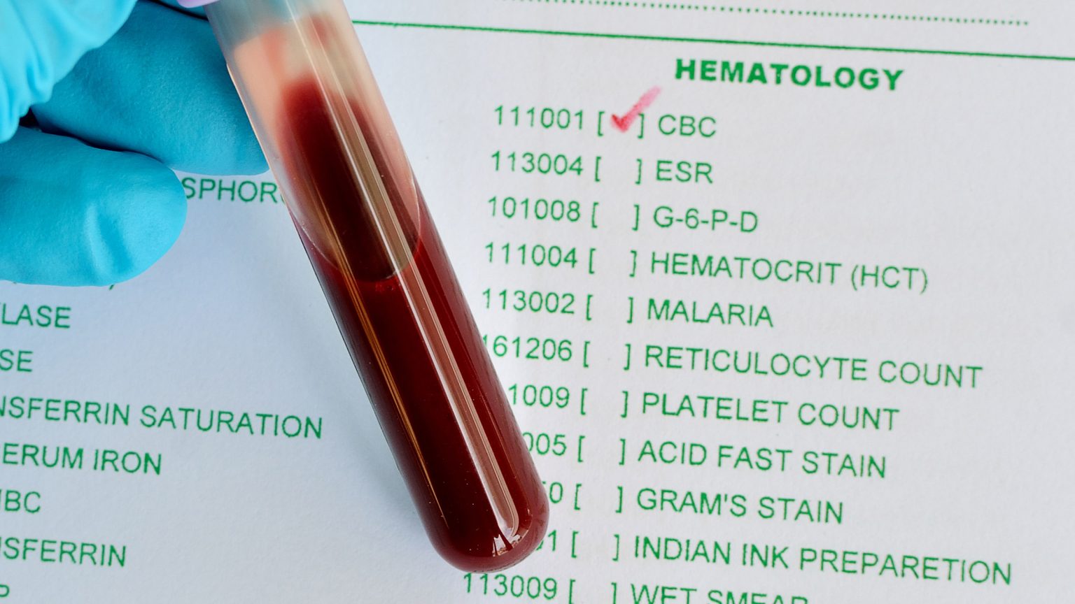 CBC Full Form: Meaning, Test, Results, Blood Level - CareerGuide