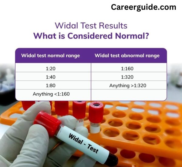 Widal test: Procedure-Principle of the Test-Limitations - CareerGuide