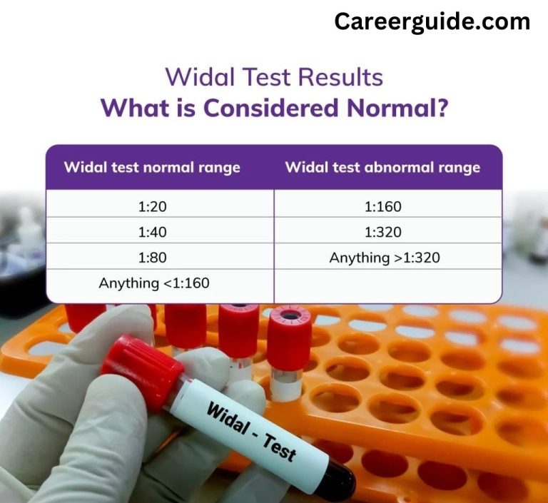 Widal test: Procedure-Principle of the Test-Limitations - CareerGuide